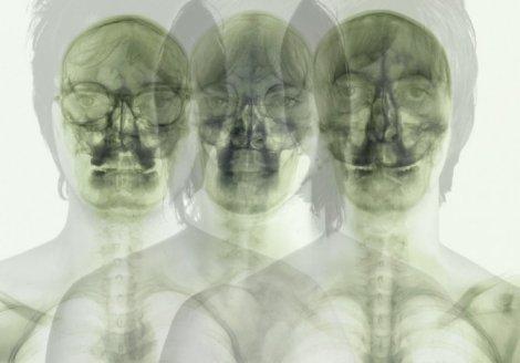 SUPERGRASS : The X-Ray Album - Culturesco